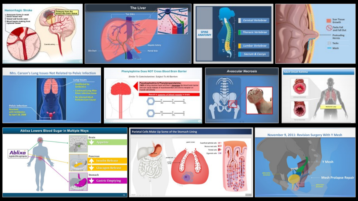Mastering the Art of Visual Advocacy: Ways to Elevate Your Trial ...